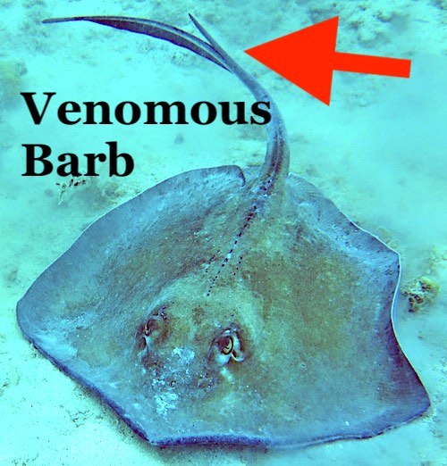 Stingray Barb Sting Stingray Sting Symptoms Treatment And More FOXJX Stingray Barb Sting Stingray Sting Symptoms Treatment And More FOXJX